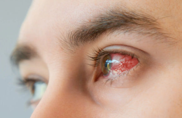 Understanding Common Eye Conditions and Their Treatments