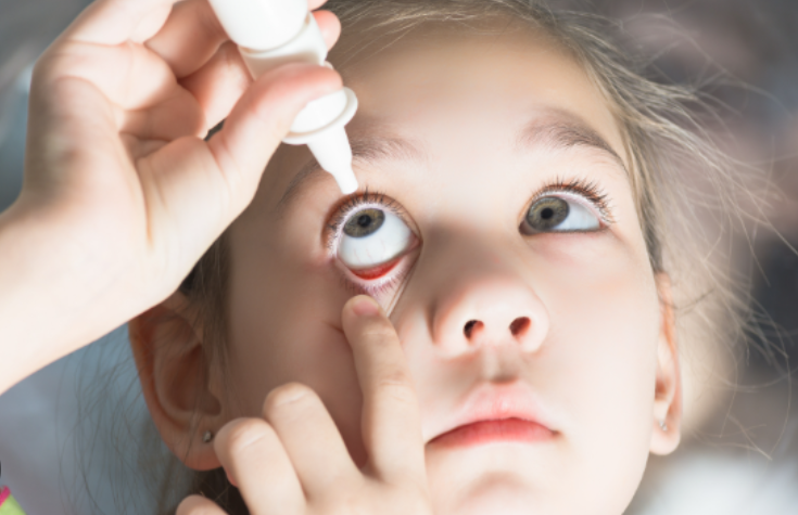 Myopia Control Lenses vs. Eye Drops: Which Works Best in 2025?